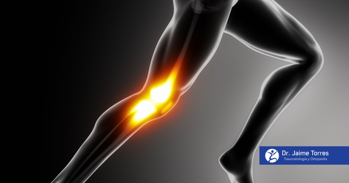Dolor detrás de la rodilla: causas más comunes y cuándo preocuparse ...
