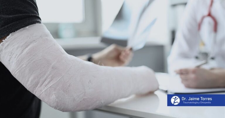 Fractura de brazo: tipos, síntomas y recuperación - Dr Jaime Torres Trejo